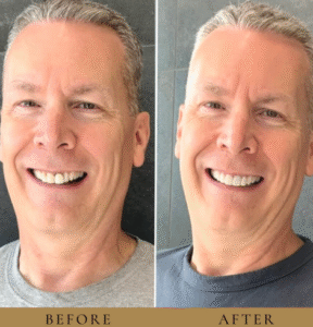 Arizona Smiles Family Dentistry and Aesthetics in Gilbert, AZ